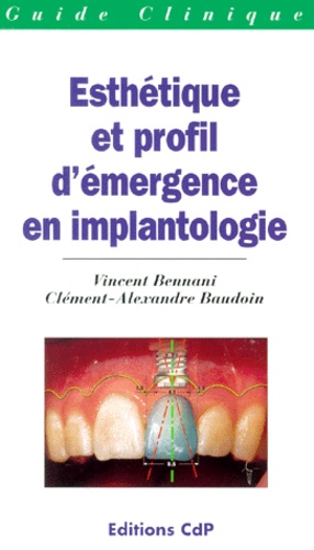 Esthetique Et Profil D'Emergence En Implantologie de Clément-Alexandre ...