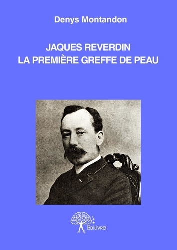 Jacques reverdin, la première greffe de peau -... de Denys Montandon ...