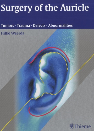 Surgery of the Auricle - Tumors, trauma, defects,... de Hilko Weerda ...