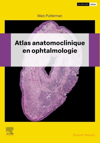 Atlas anatomoclinique en ophtalmologie de Marc Putterman - Grand Format ...