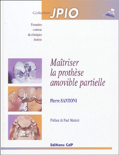 Maîtriser la prothèse amovible partielle de Pierre Santoni - Livre ...